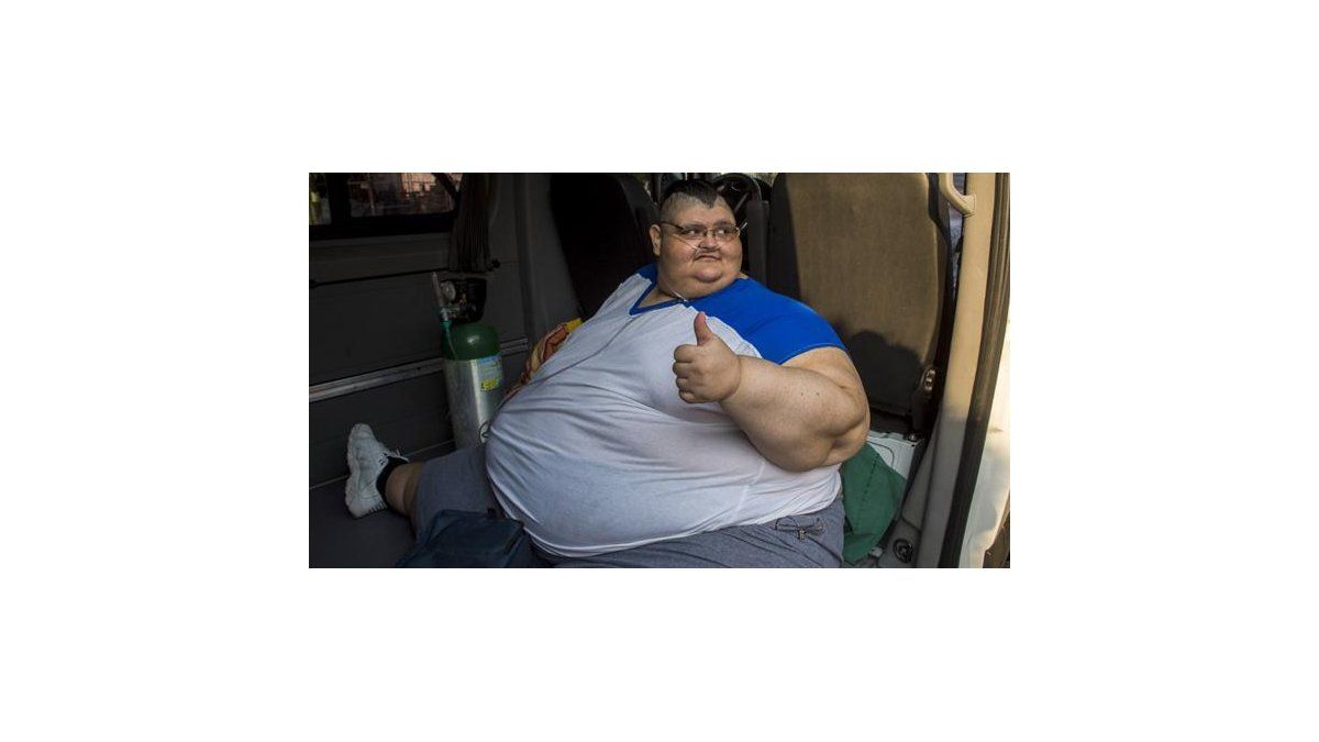 Hombre más obeso del mundo sometido con éxito a reducción de estómago