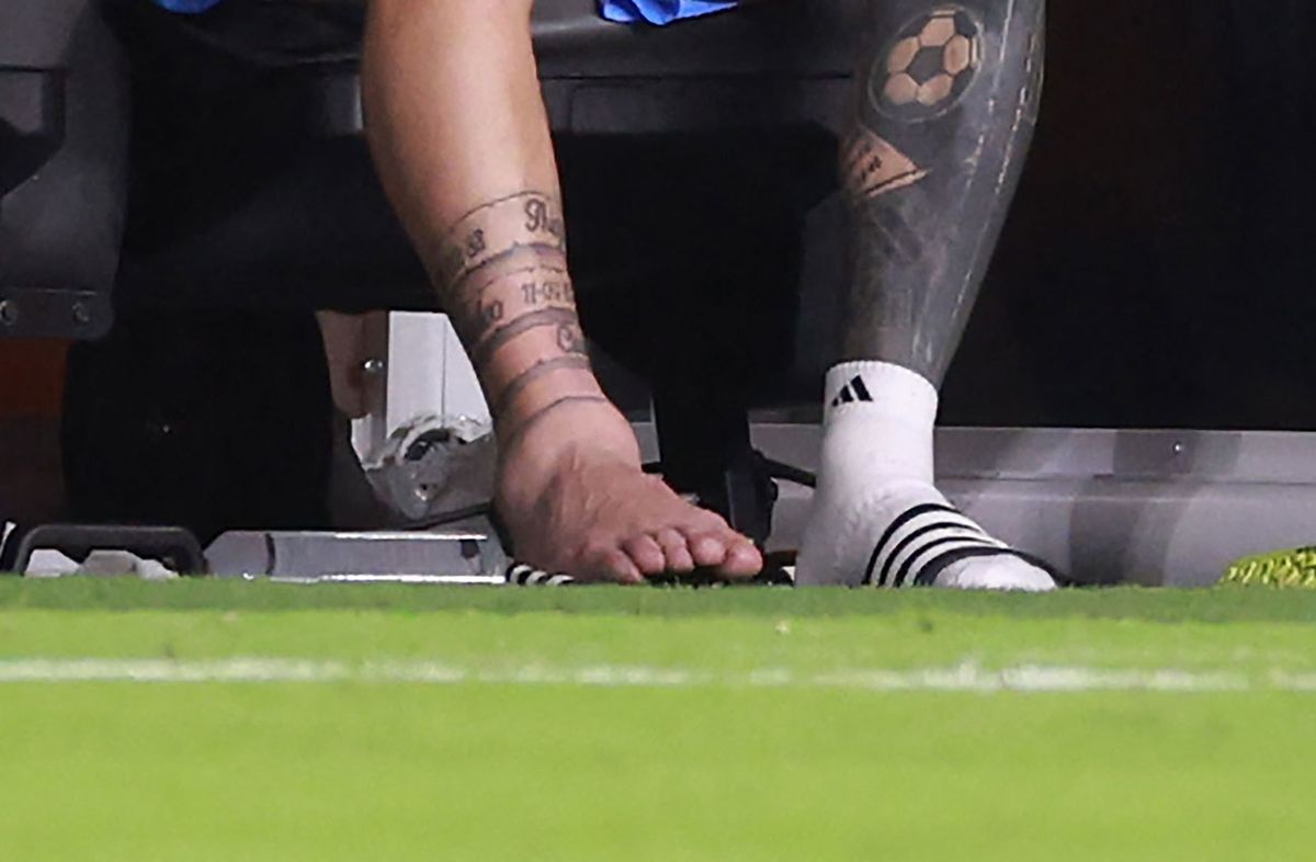 Así quedó el tobillo de Messi, una lesión que lo sacó de la final en el ...