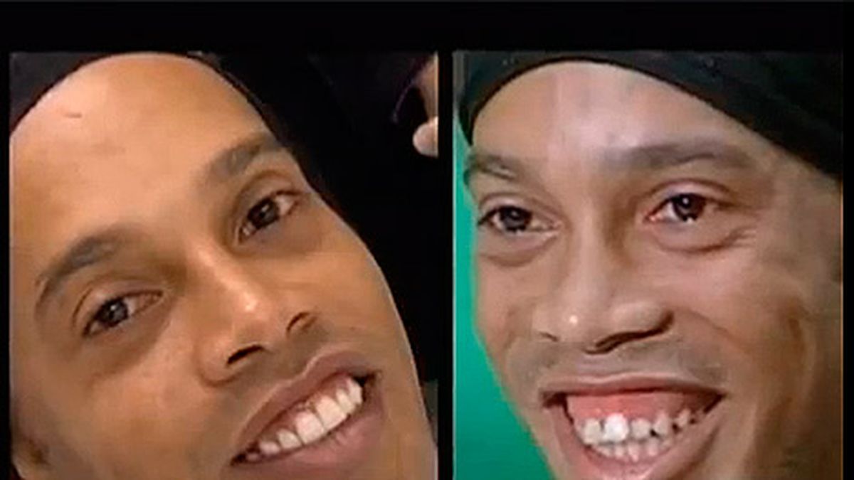 Así fue el tratamiento dental que se hizo Ronaldinho Gaúcho