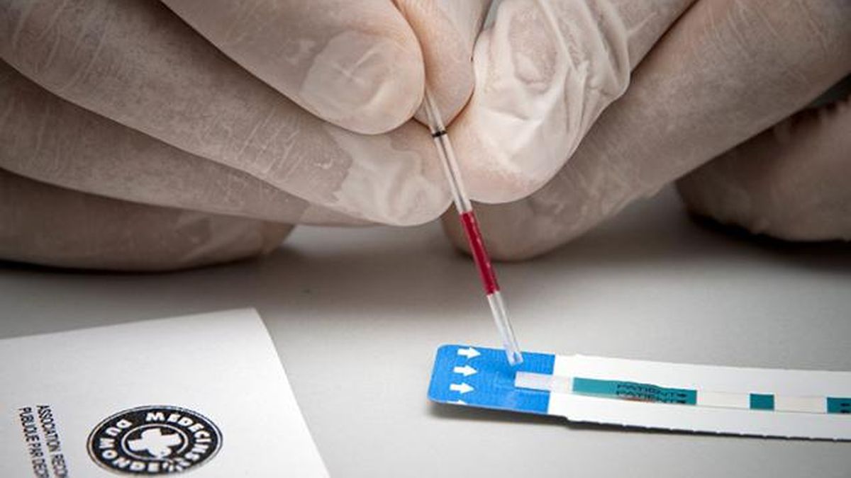 Realizan test rápido de diagnóstico de VIH-SIDA en todo el país