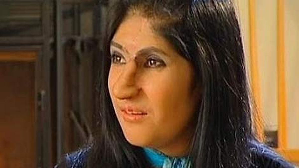 Aisha Mohamadzai: El castigo era cortarme la nariz y las orejas